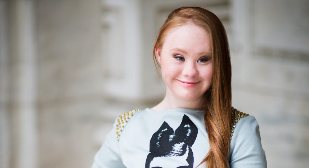 Madeline Stuart, Gadis OKU Down Syndrome Pertama Bergelar Supermodel Di ...