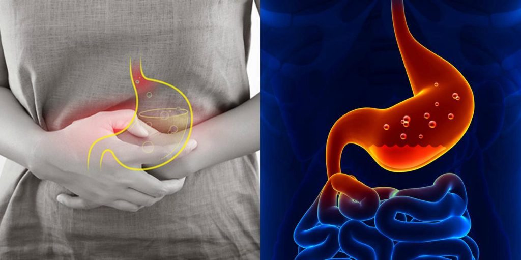 Anggun & Sihat Usia 70, Ibu Rozita Che Wan Akui Ikut Amalan Berpantang ...