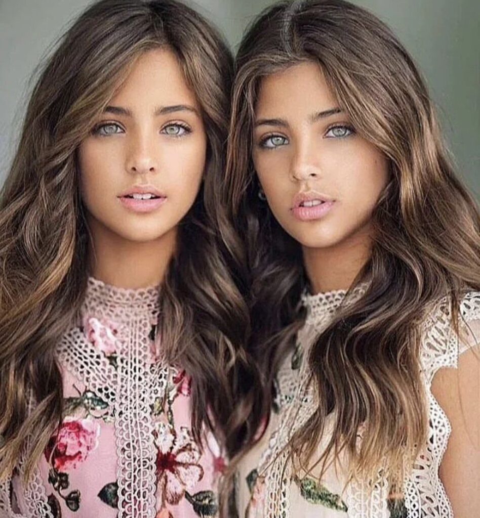 Wajah Terkini Kembar Tercantik Di Dunia AVA & LEAH, Kini Berusia ...